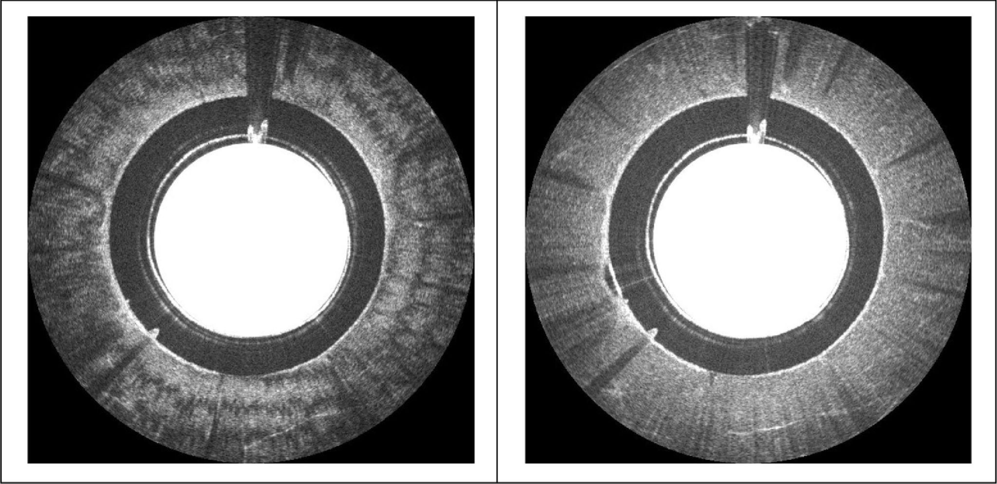 Researchers Develop Optical Tomography System with BitFlow Frame ...